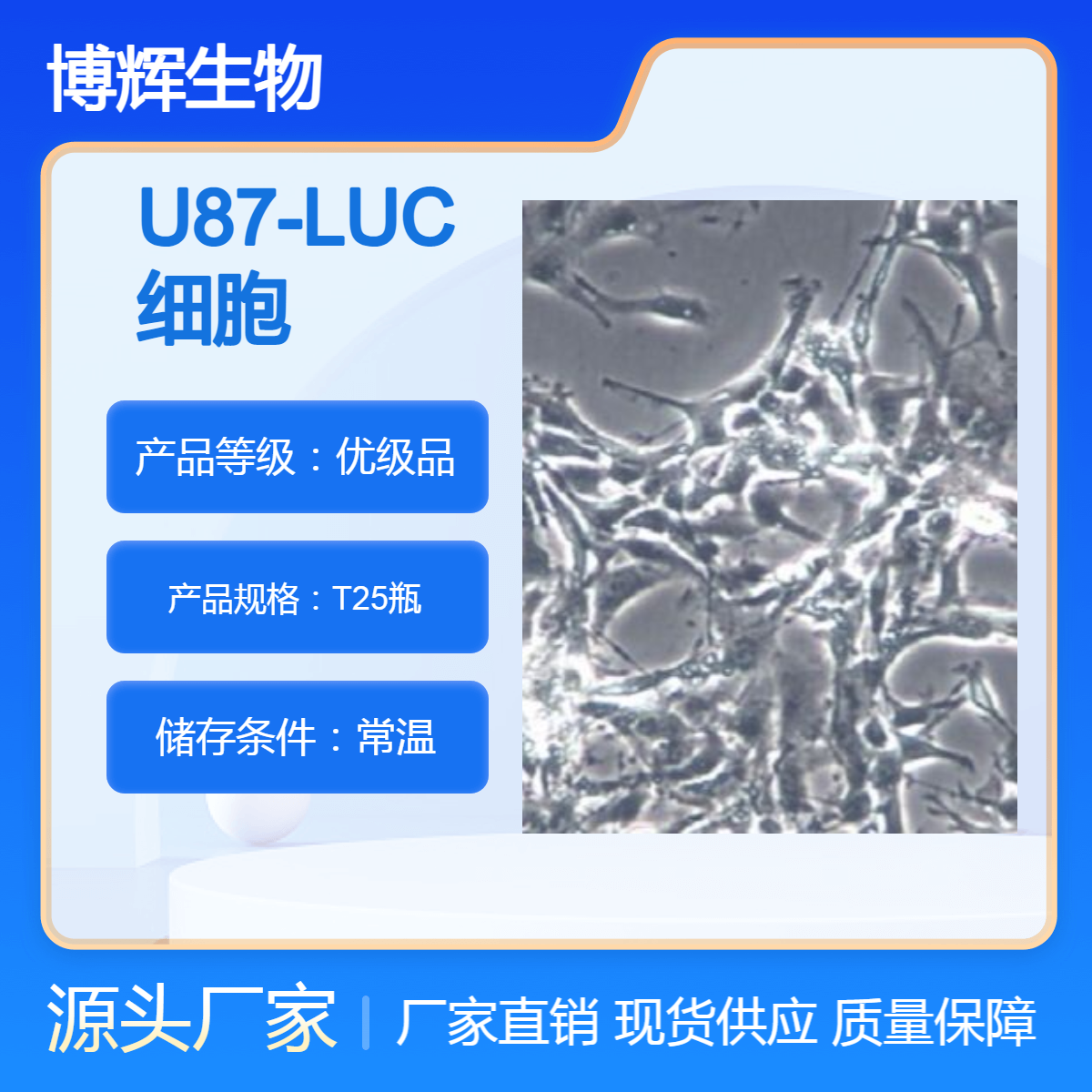 U87-LUC人脑星形胶质母细胞瘤细胞-荧光素酶标记提供STR鉴定报告 产品关键词:u87-细胞luc;u87-luc细胞